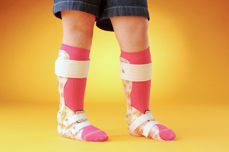 Photo Gallery | Orthologix | Pediatric Orthotics